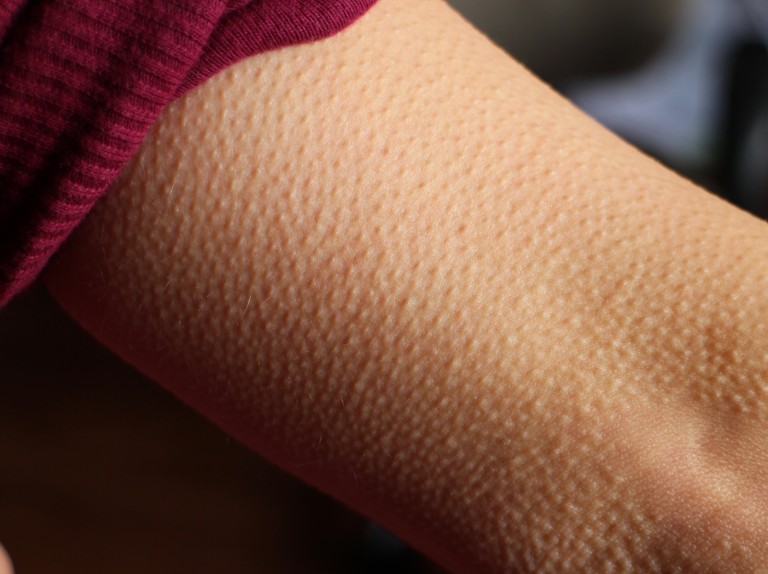 Skin Goosebumps - نظرية التطور - التطور بالعربية